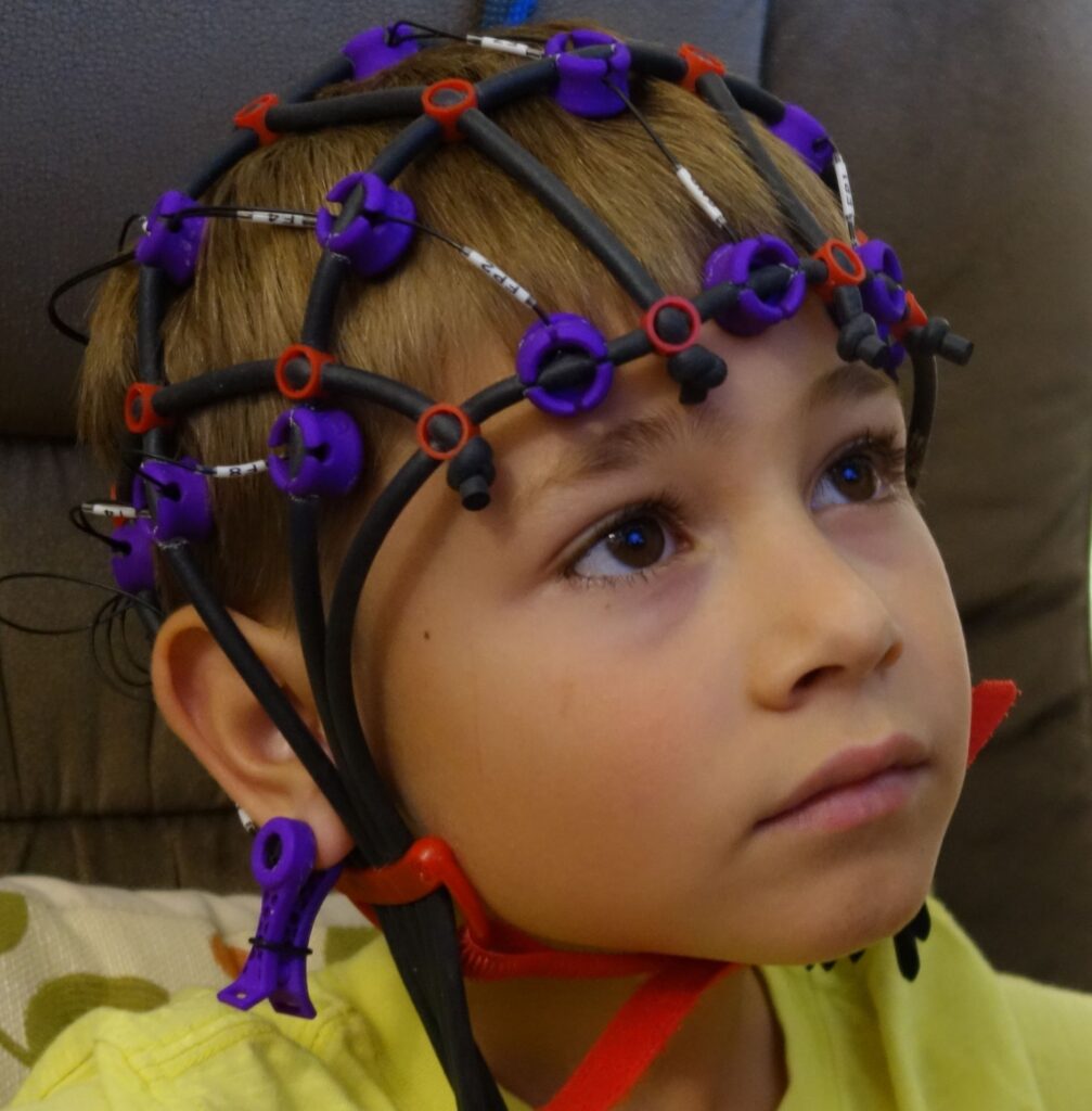 Neurofeedback - Peak Clarity Experiential Counseling & Neurofeedback